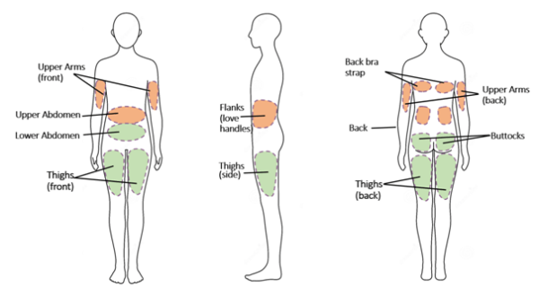Vacuum-Therapy-treatment-area | Body Contouring Courses